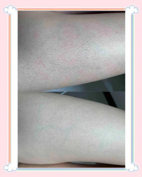 鸡皮肤长什么样子_鸡皮肤图片真实照片-第2张图片-山城妙识