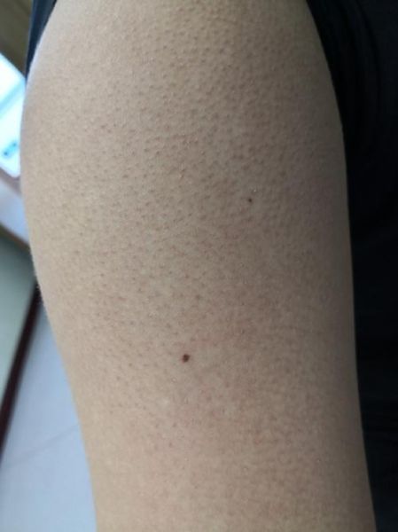 鸡皮肤长什么样子_鸡皮肤图片真实照片-第3张图片-山城妙识