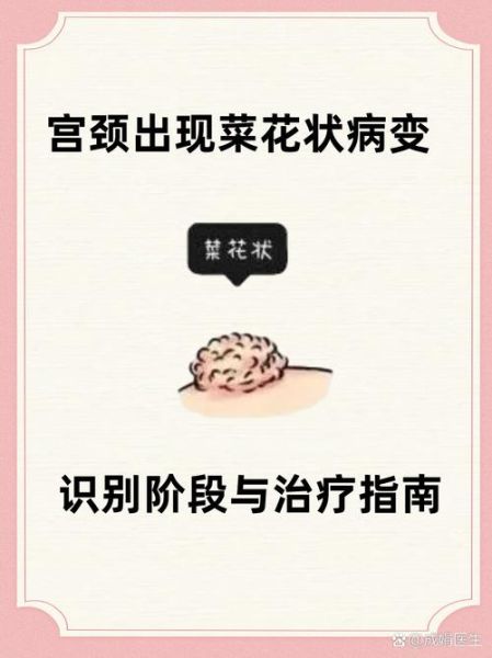 菜花样病变是什么_怎么治疗-第2张图片-山城妙识