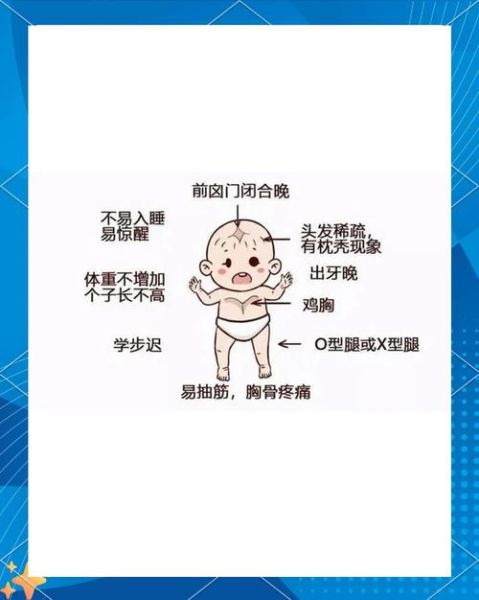 佝偻病早期症状图片_佝偻病能治好吗-第3张图片-山城妙识