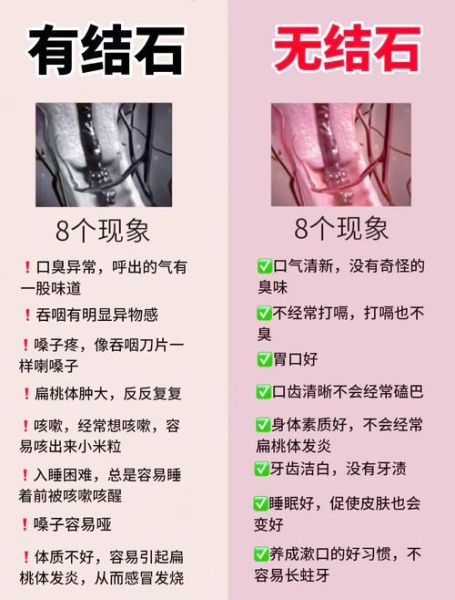 去除口臭的偏方有哪些_口臭怎么快速消除-第1张图片-山城妙识