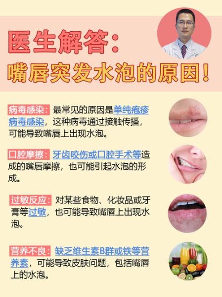嘴唇上火起泡怎么快速消除_嘴角起泡几天能好-第1张图片-山城妙识 嘴唇上火起泡怎么快速消除_嘴角起泡几天能好-第1张图片-山城妙识