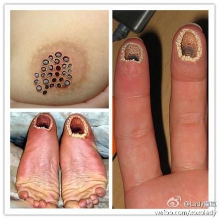 密集恐惧症图片测试图_怎么判断自己有没有密集恐惧症-第1张图片-山城妙识