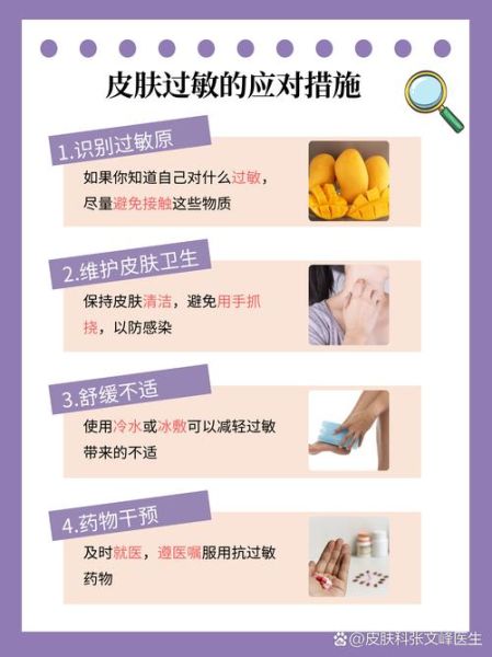 皮肤过敏了怎么办最快方法_皮肤过敏止痒小妙招-第3张图片-山城妙识