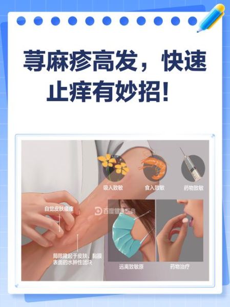皮肤过敏了怎么办最快方法_皮肤过敏止痒小妙招-第2张图片-山城妙识