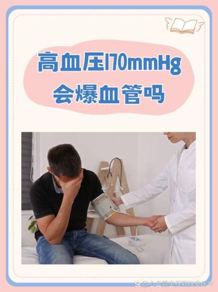 血压170严重吗_高血压170怎么办-第1张图片-山城妙识
