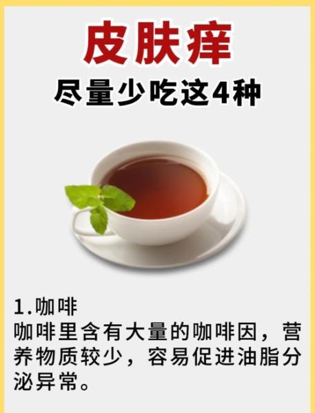 慢性荨麻疹不能吃什么_慢性荨麻疹忌口食物清单-第2张图片-山城妙识