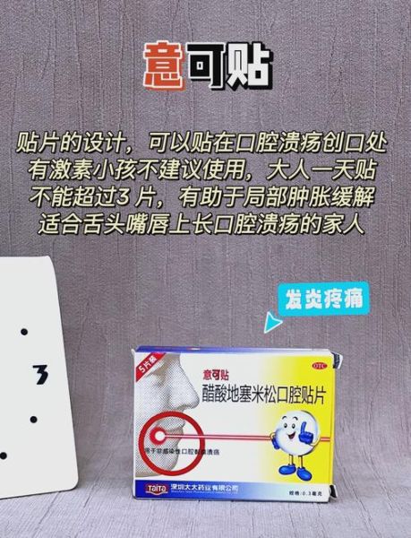 口腔溃疡吃什么药好_口腔溃疡怎么快速止痛-第1张图片-山城妙识 口腔溃疡吃什么药好_口腔溃疡怎么快速止痛-第1张图片-山城妙识