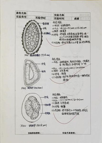 如何判断自己体内有寄生虫_寄生虫检测方法有哪些-第3张图片-山城妙识 如何判断自己体内有寄生虫_寄生虫检测方法有哪些-第3张图片-山城妙识