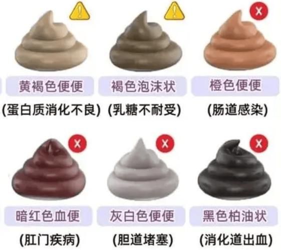 早期肠癌大便图片_肠癌大便颜色形状变化-第3张图片-山城妙识 早期肠癌大便图片_肠癌大便颜色形状变化-第3张图片-山城妙识