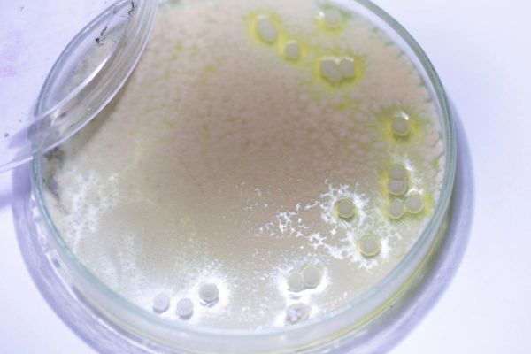 酸汤子中毒是什么菌_米酵菌酸中毒症状-第1张图片-山城妙识 酸汤子中毒是什么菌_米酵菌酸中毒症状-第1张图片-山城妙识