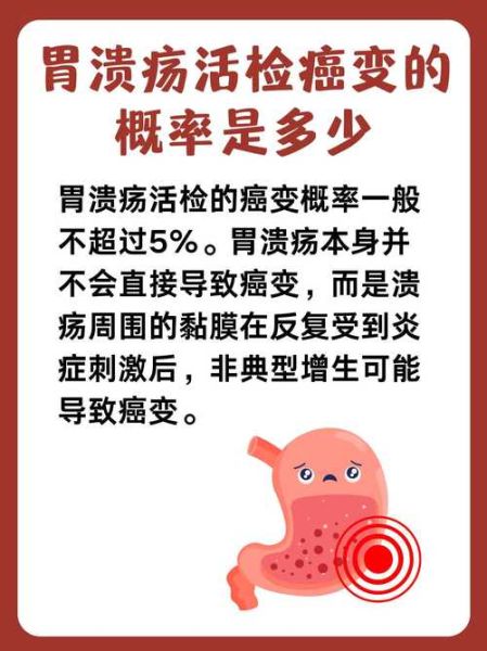 得了胃溃疡能活多少年_胃溃疡会不会影响寿命-第3张图片-山城妙识