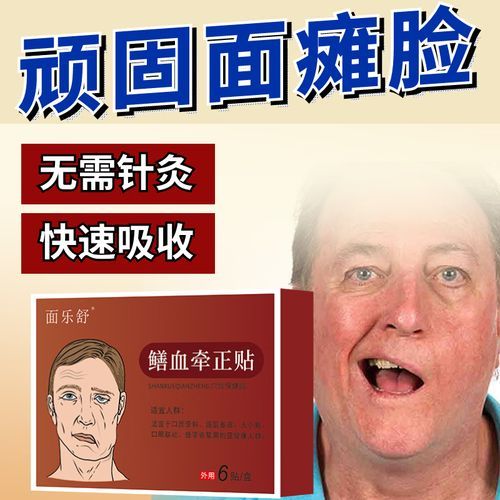 黄鳝血治疗面瘫的步骤_黄鳝血治面瘫有效吗-第3张图片-山城妙识 黄鳝血治疗面瘫的步骤_黄鳝血治面瘫有效吗-第3张图片-山城妙识