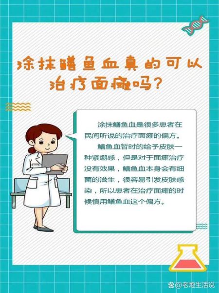 黄鳝血治疗面瘫的步骤_黄鳝血治面瘫有效吗-第1张图片-山城妙识 黄鳝血治疗面瘫的步骤_黄鳝血治面瘫有效吗-第1张图片-山城妙识