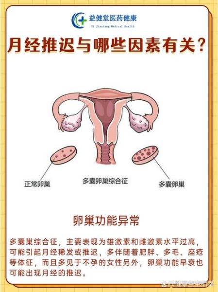 月经推迟10天正常吗_月经推迟10天怎么办-第3张图片-山城妙识