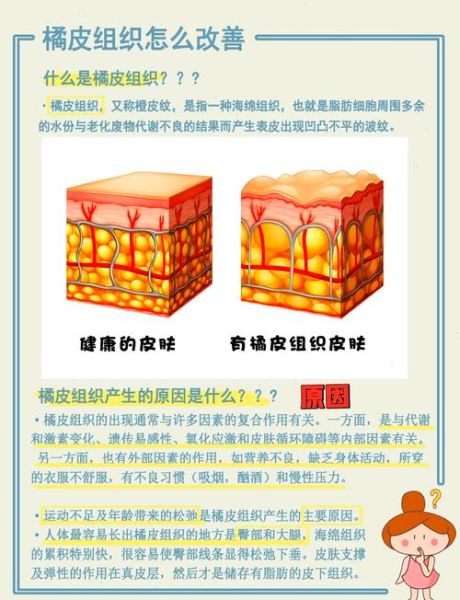 橘皮组织怎么消除_橘皮组织是怎么形成的-第3张图片-山城妙识