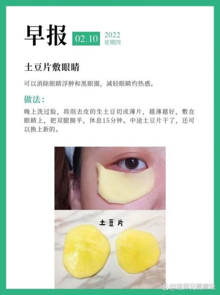 土豆片外敷消肿多久见效_土豆片外敷能去黑眼圈吗-第1张图片-山城妙识
