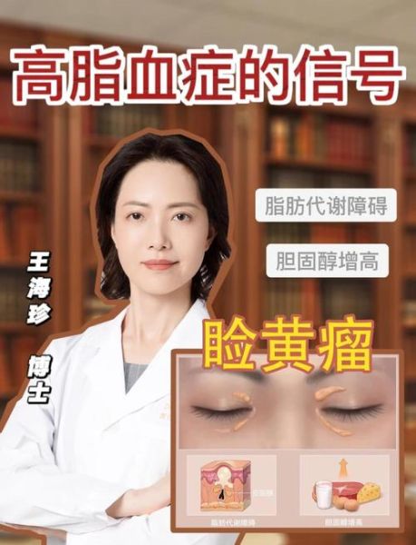 血脂高眼睛有哪些症状_高血脂眼部信号-第1张图片-山城妙识