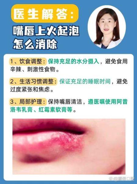 嘴唇起泡是什么原因_睡一觉醒来上唇肿了怎么办-第2张图片-山城妙识 嘴唇起泡是什么原因_睡一觉醒来上唇肿了怎么办-第2张图片-山城妙识