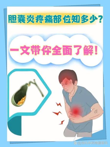 女性胆囊炎有什么症状_胆囊炎疼痛位置在哪-第3张图片-山城妙识