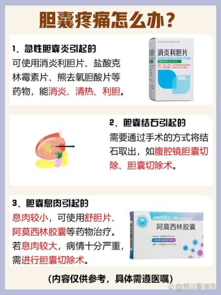 女性胆囊炎有什么症状_胆囊炎疼痛位置在哪-第1张图片-山城妙识