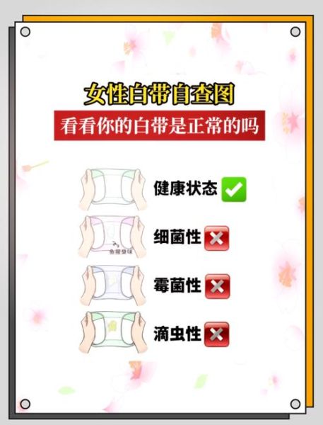 豆腐渣样白带是什么感染_怎么治疗-第1张图片-山城妙识 豆腐渣样白带是什么感染_怎么治疗-第1张图片-山城妙识