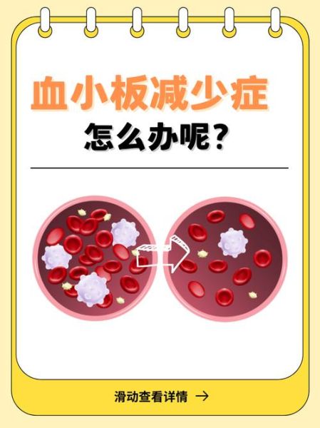 血小板低能自己恢复吗_血小板减少多久能自愈-第1张图片-山城妙识 血小板低能自己恢复吗_血小板减少多久能自愈-第1张图片-山城妙识