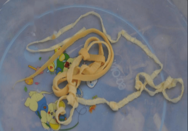 猪肉绦虫煮熟后是什么样子_彻底杀死囊尾蚴需要多少温度-第3张图片-山城妙识