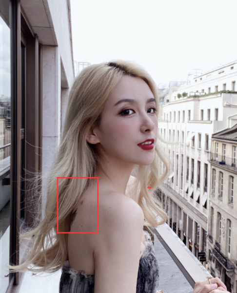 草莓印怎么快速消除_草莓印多久能自然消退-第1张图片-山城妙识 草莓印怎么快速消除_草莓印多久能自然消退-第1张图片-山城妙识