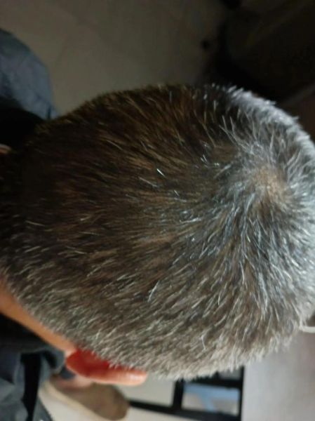 亚麻籽油治白发真的有用吗_白发吃亚麻籽油多久见效-第1张图片-山城妙识 亚麻籽油治白发真的有用吗_白发吃亚麻籽油多久见效-第1张图片-山城妙识