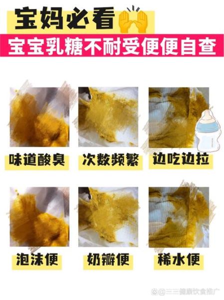 蛋花汤样大便怎么回事_蛋花汤样大便怎么办-第1张图片-山城妙识