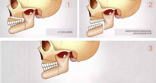 颌怎么读_颌字发音及常见误区-第3张图片-山城妙识 颌怎么读_颌字发音及常见误区-第3张图片-山城妙识