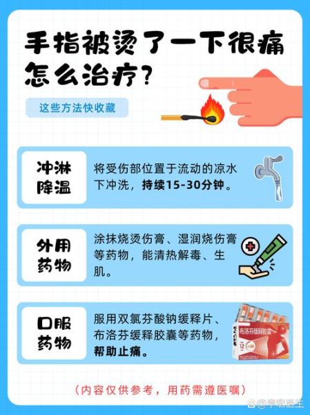 手指灼烧感又辣怎么办_辣椒辣手最快缓解方法-第2张图片-山城妙识
