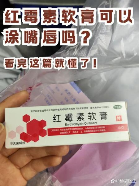 嘴唇上长水泡可以涂红霉素软膏吗_多久能好-第3张图片-山城妙识 嘴唇上长水泡可以涂红霉素软膏吗_多久能好-第3张图片-山城妙识