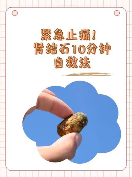 半夜肾结石疼痛自救方法_肾结石发作怎么缓解-第1张图片-山城妙识 半夜肾结石疼痛自救方法_肾结石发作怎么缓解-第1张图片-山城妙识