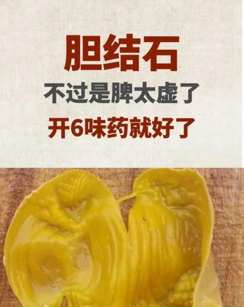胆结石吃什么好排石呢_胆结石排石食物有哪些-第3张图片-山城妙识