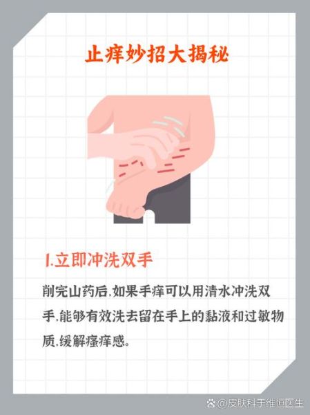 山药痒手怎么办_最快止痒方法-第3张图片-山城妙识 山药痒手怎么办_最快止痒方法-第3张图片-山城妙识