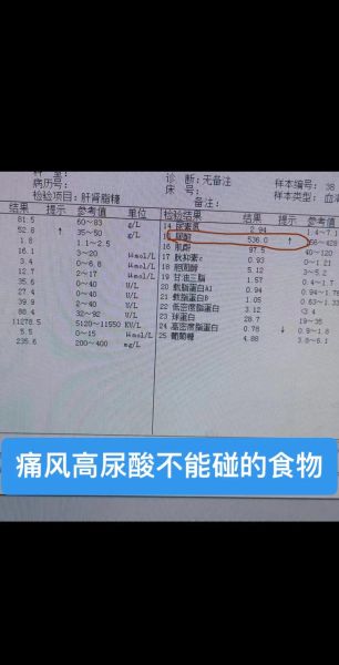 尿酸600还有救吗_高尿酸如何降下来-第2张图片-山城妙识 尿酸600还有救吗_高尿酸如何降下来-第2张图片-山城妙识