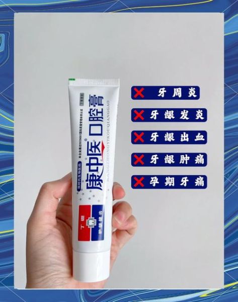 上火牙龈肿痛吃什么药_牙龈肿痛吃什么药最管用-第1张图片-山城妙识