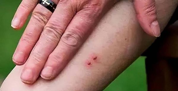 农村十大毒蛇有哪些_被咬后怎么办-第3张图片-山城妙识 农村十大毒蛇有哪些_被咬后怎么办-第3张图片-山城妙识