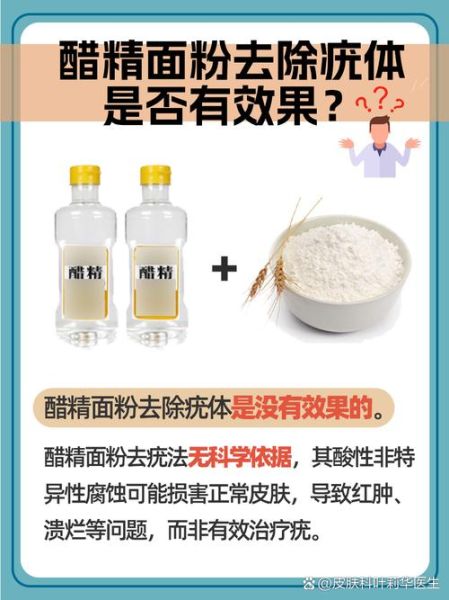 醋精加白面去疣的正确方法_多久能见效-第2张图片-山城妙识