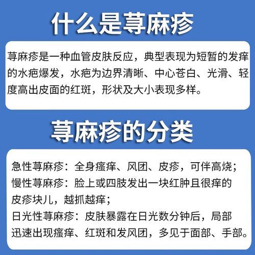 抗过敏药哪个好_抗过敏药多久见效-第2张图片-山城妙识