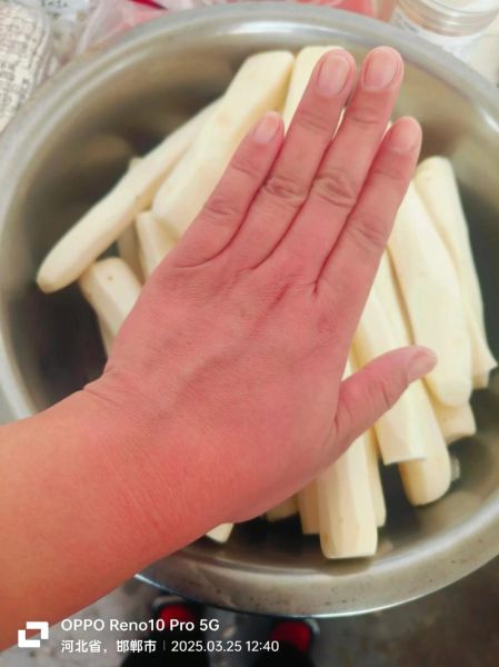 摸了山药怎么止痒_山药手痒最快止痒方法-第2张图片-山城妙识