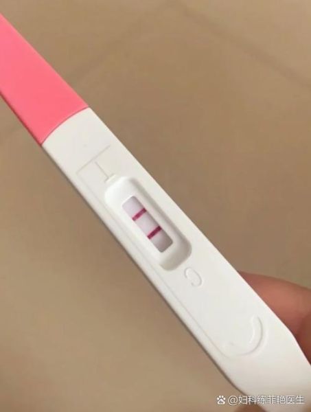 二条杠后多久去医院_验孕棒阳性多久做检查-第1张图片-山城妙识