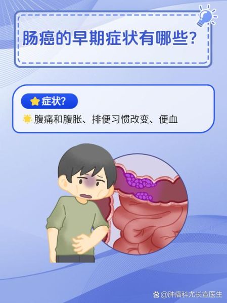 大肠癌的早期症状有哪些_如何及时发现-第3张图片-山城妙识 大肠癌的早期症状有哪些_如何及时发现-第3张图片-山城妙识