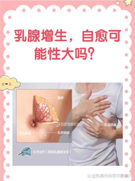 乳腺增生可以消除吗_乳腺增生会自愈吗-第3张图片-山城妙识