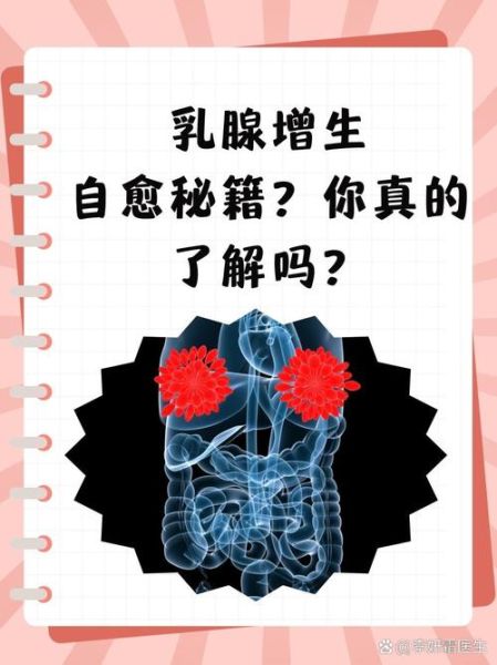 乳腺增生可以消除吗_乳腺增生会自愈吗-第2张图片-山城妙识