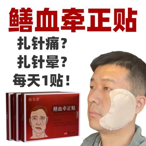 鳝鱼血治面瘫真的有用吗_鳝鱼血治面瘫偏方原理-第1张图片-山城妙识