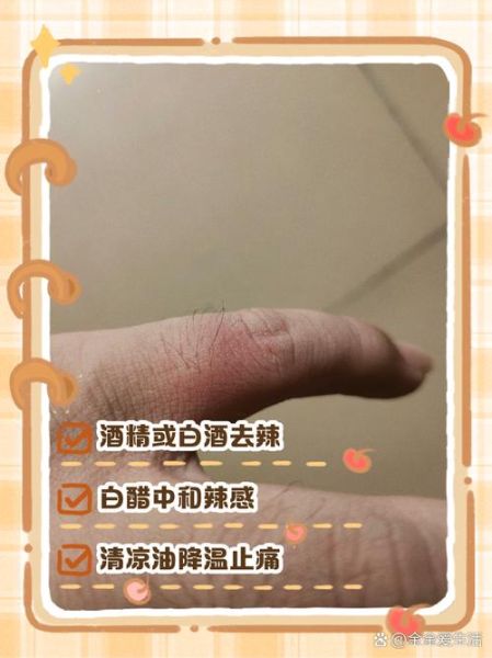 手被辣椒辣了怎么办_最快消除灼烧感-第2张图片-山城妙识