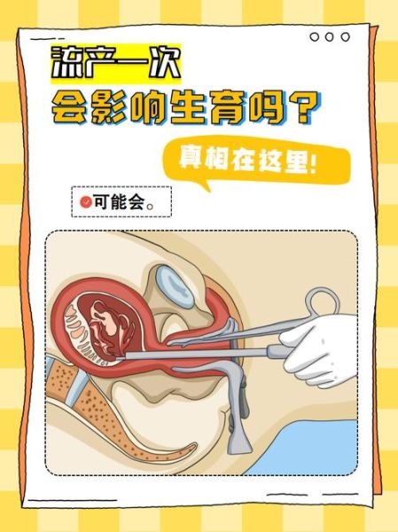 怎么自己流产_自己流产安全吗-第2张图片-山城妙识